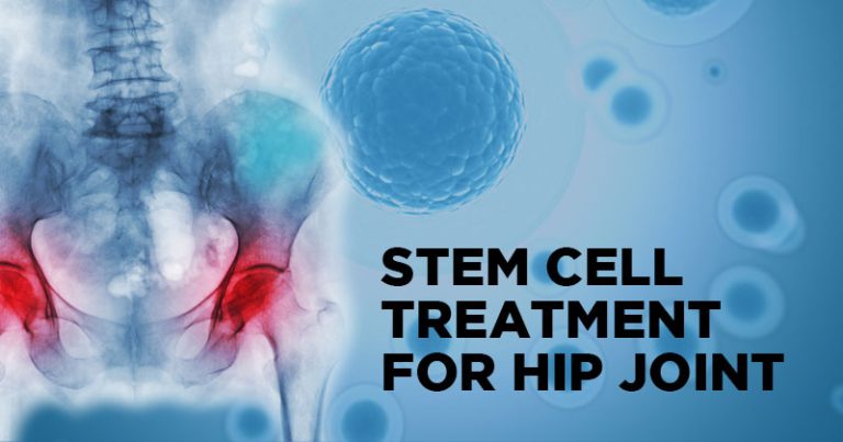 Stem Cell Therapy & Regenerative Medicine in Miami | Miami Stem Cell